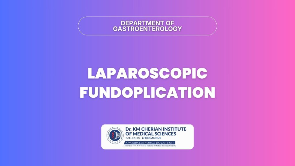 Finding Relief For Chronic Acidity When To Consider Laparoscopic